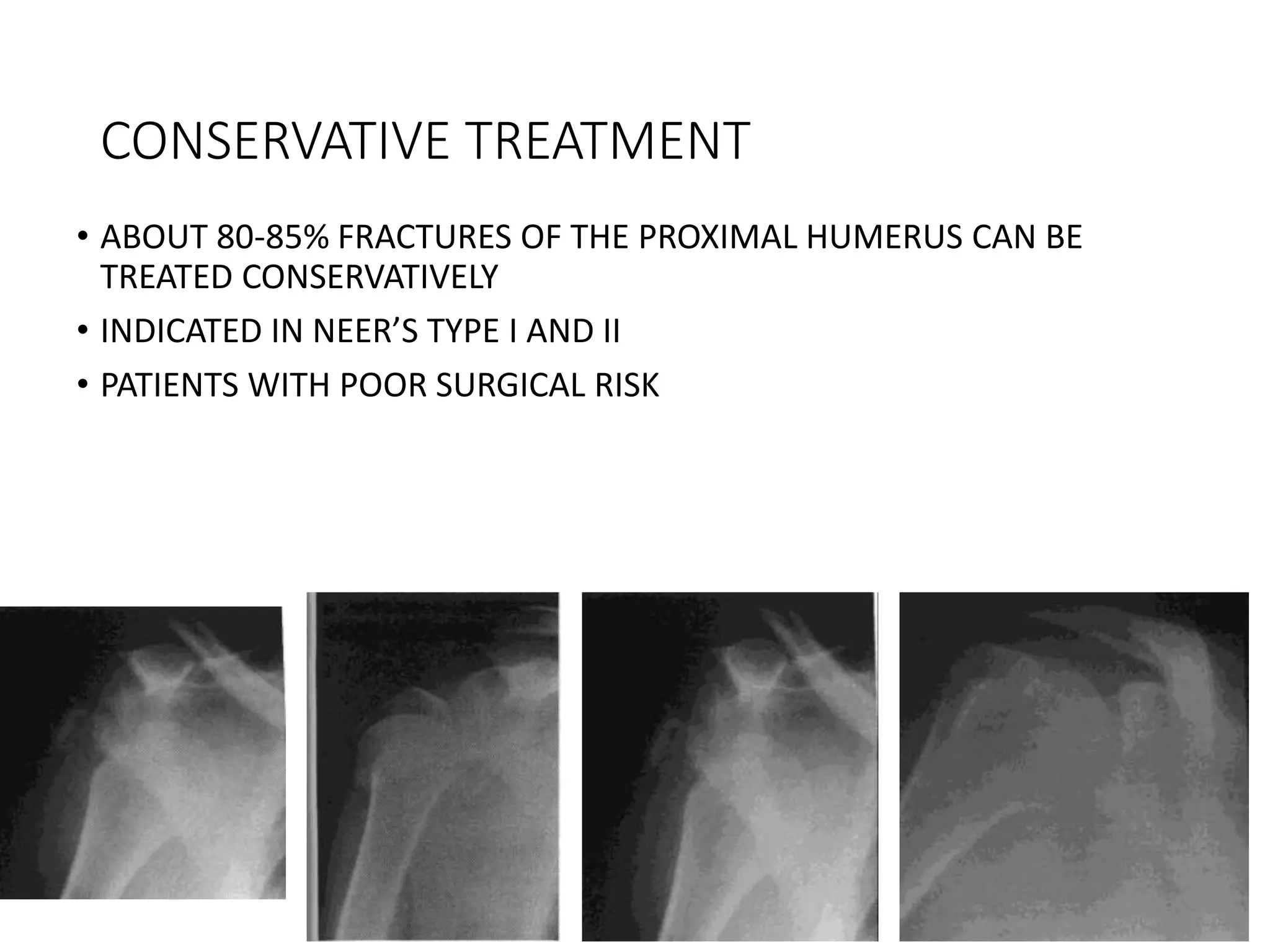 Shoulder Injuriespptx