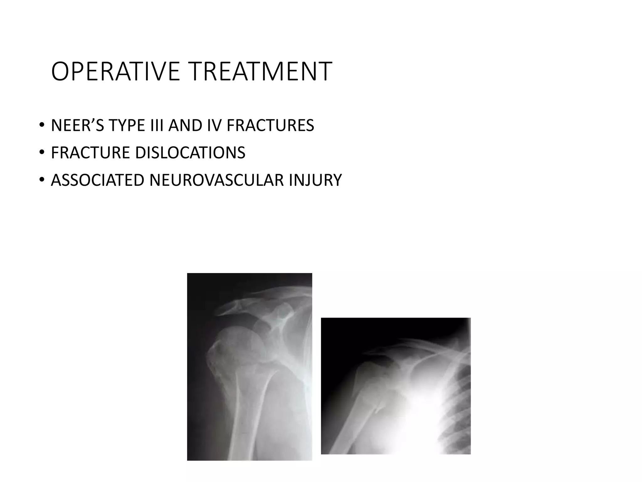 Shoulder Injuriespptx