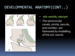 Dr ABI OTOSCELEROSIS.pptx