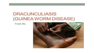 Dracunculiasis | ODP | Infectious Diseases | Diseases and Conditions