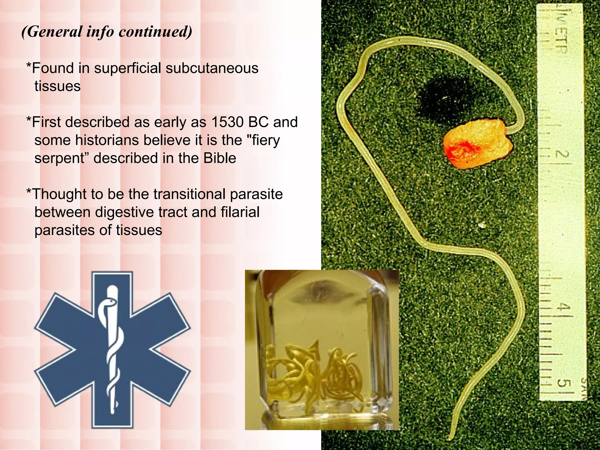 Dracunculiasis (Dracunculus medinensis) (guinea worm disease) | PPT