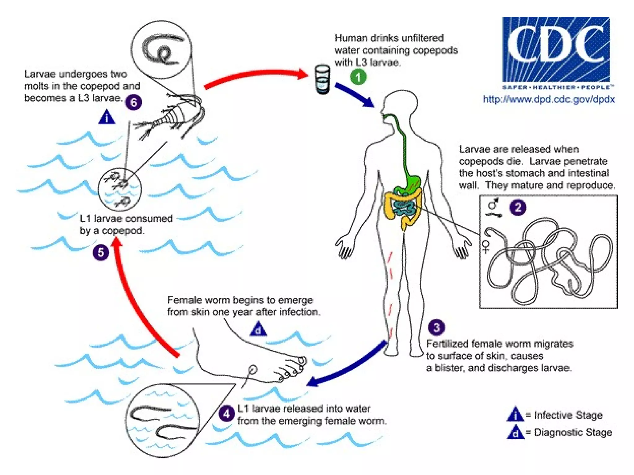 Dracunculiasis (Dracunculus medinensis) (guinea worm disease) | PPT