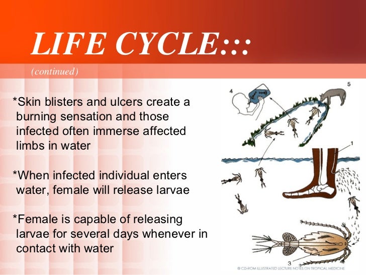Dracunculiasis (Dracunculus medinensis) (guinea worm disease)