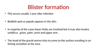 dracunculusrhrtrtmryj-220328011535 (1).pptx