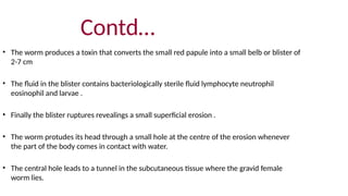 dracunculusrhrtrtmryj-220328011535 (1).pptx