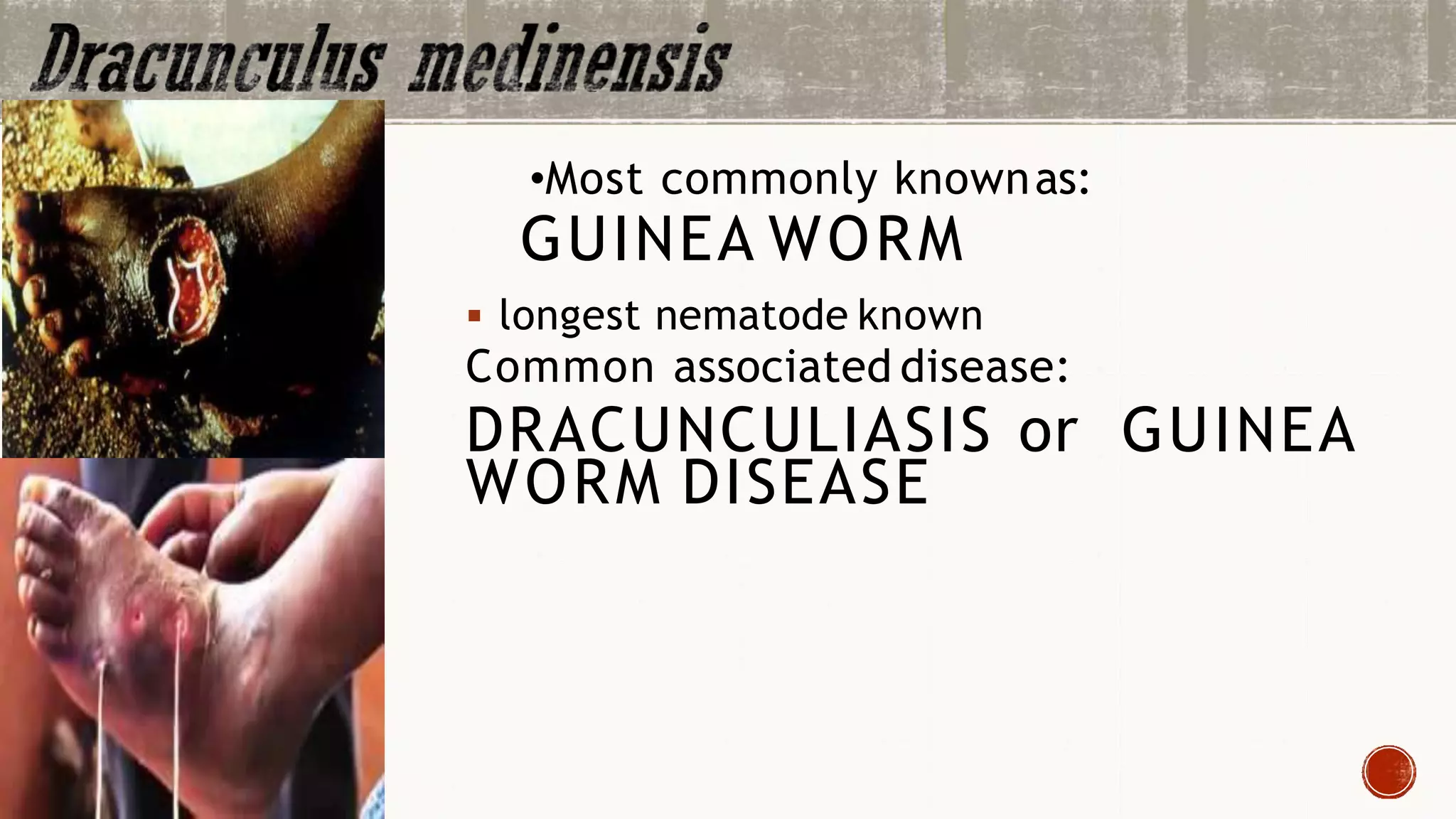 Dracunculus medinensis | PPTX