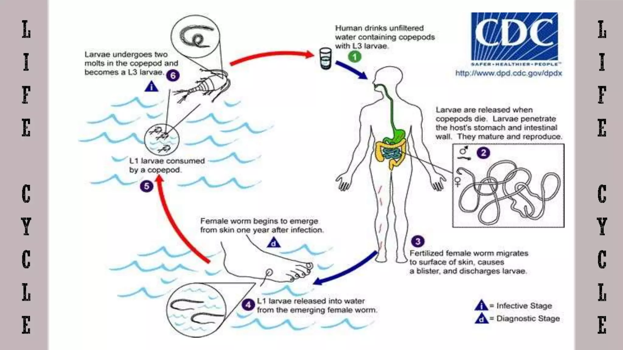 Dracunculus medinensis | PPTX