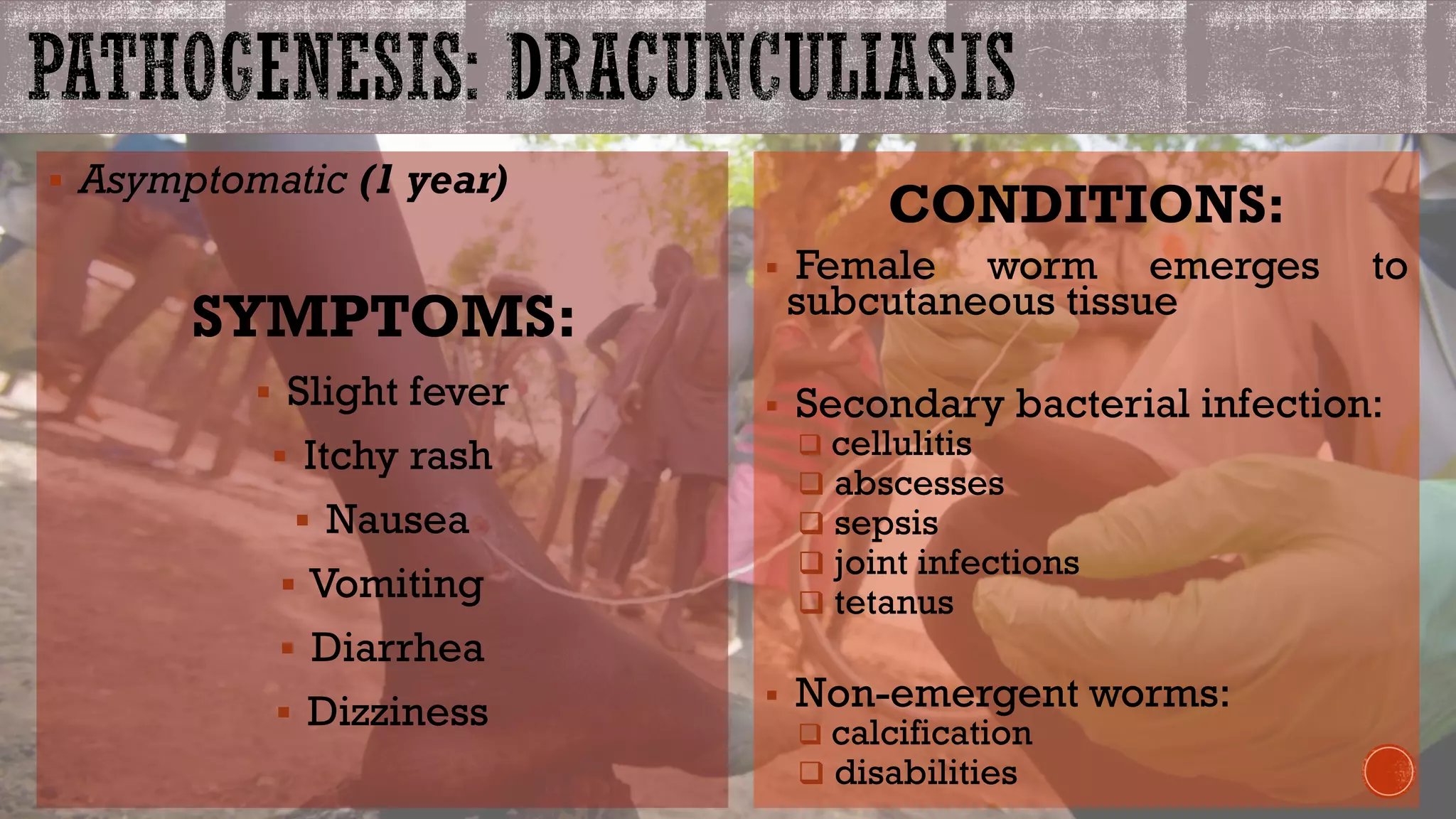 Dracunculus medinensis | PDF