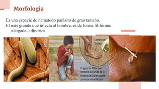 Dracunculus_medinensis Y WUCHERERIA carolina.pptx