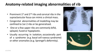 Diaphragm and chest wall anatomy with some clinical correlates | PPTX