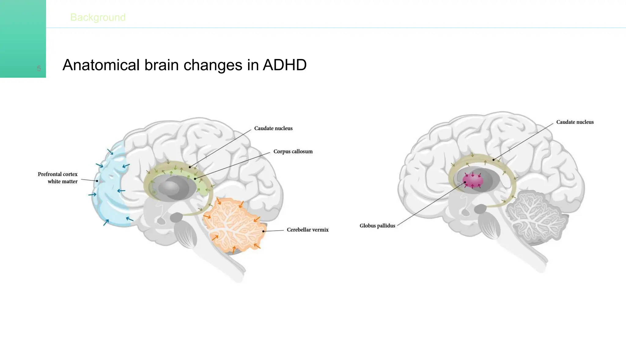 Genetics and epigenetics of ADHD and comorbid conditions | PPTX