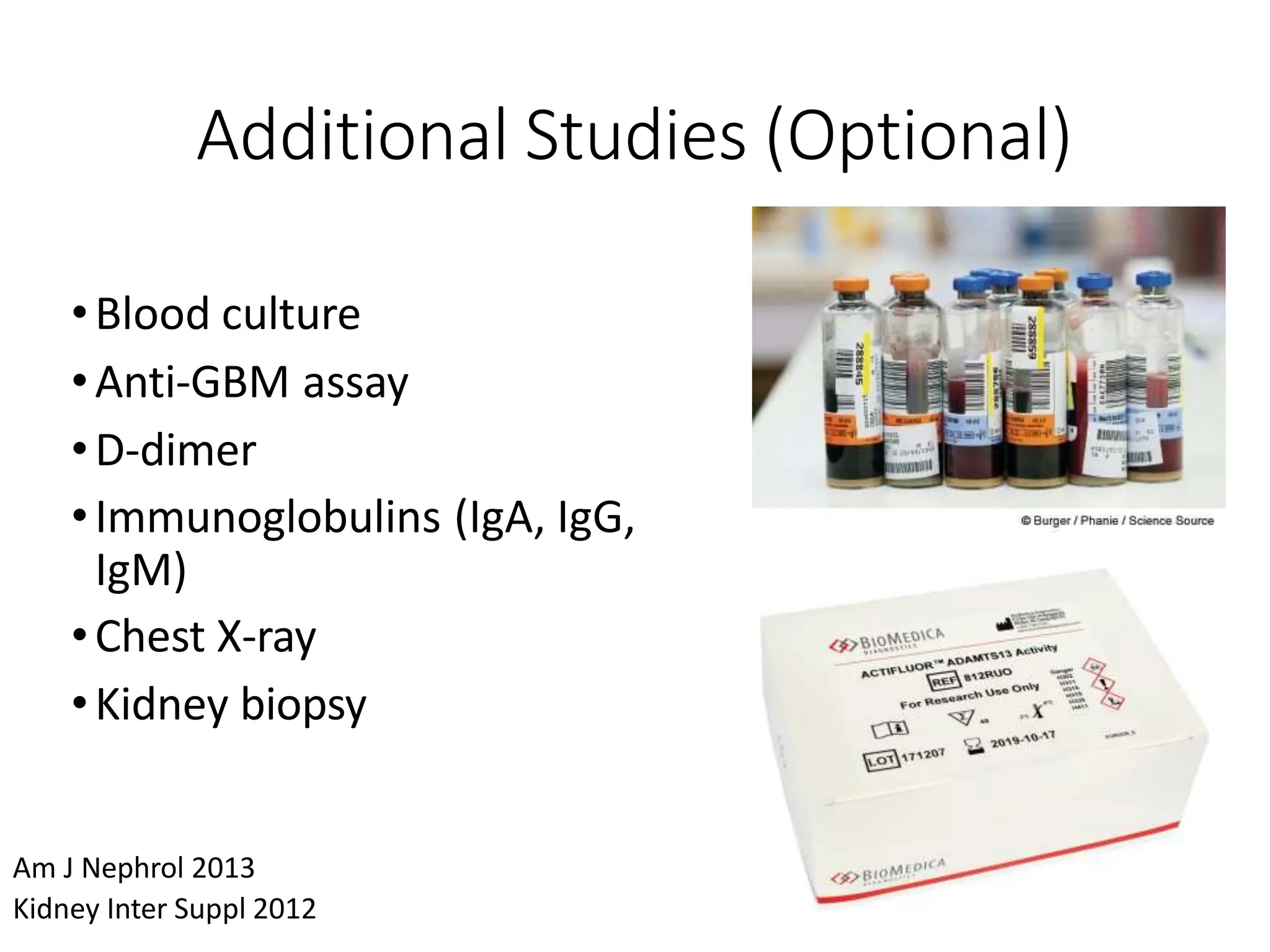 dr Aida Lydia - Practical Approach in CLomerular Disease (1).pptx ...