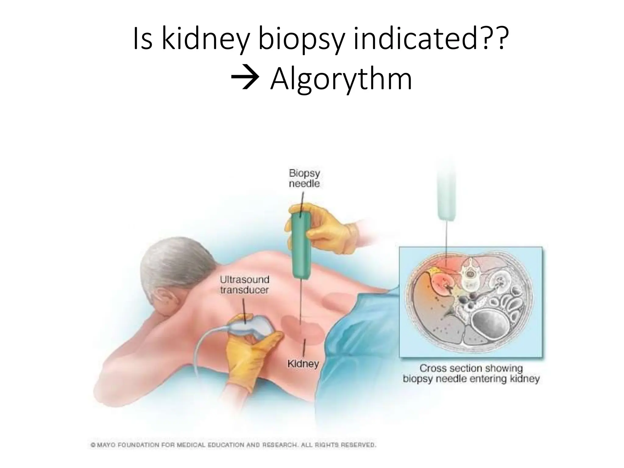 dr Aida Lydia - Practical Approach in CLomerular Disease (1).pptx ...