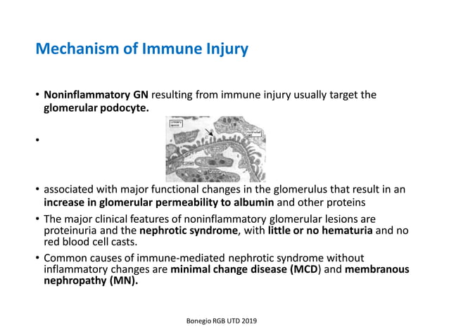 dr Aida Lydia - Practical Approach in CLomerular Disease (1).pptx