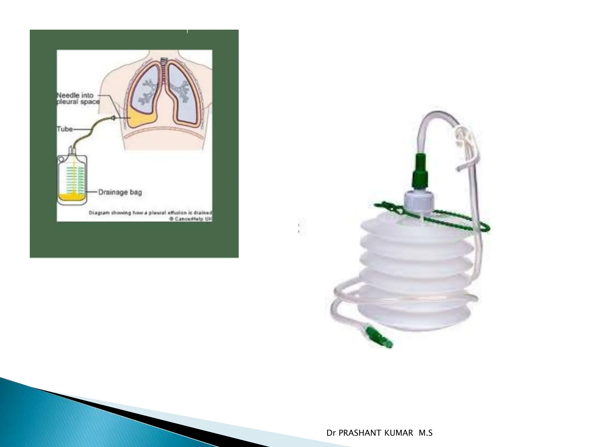 Drainage system.pptx