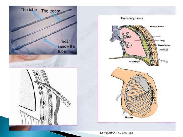 Drainage system.pptx
