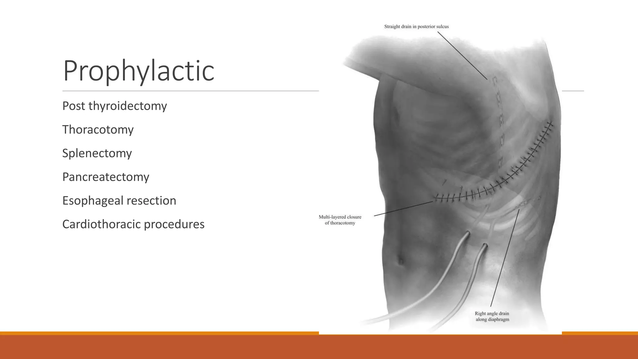 Surgical Drains | PPTX