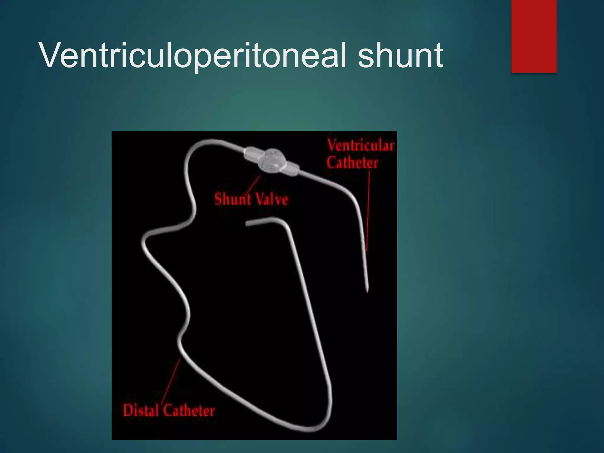 DRAINS AND DRAINAGE SYSTEMS IN SURGERY PPT - Corrected.ppt
