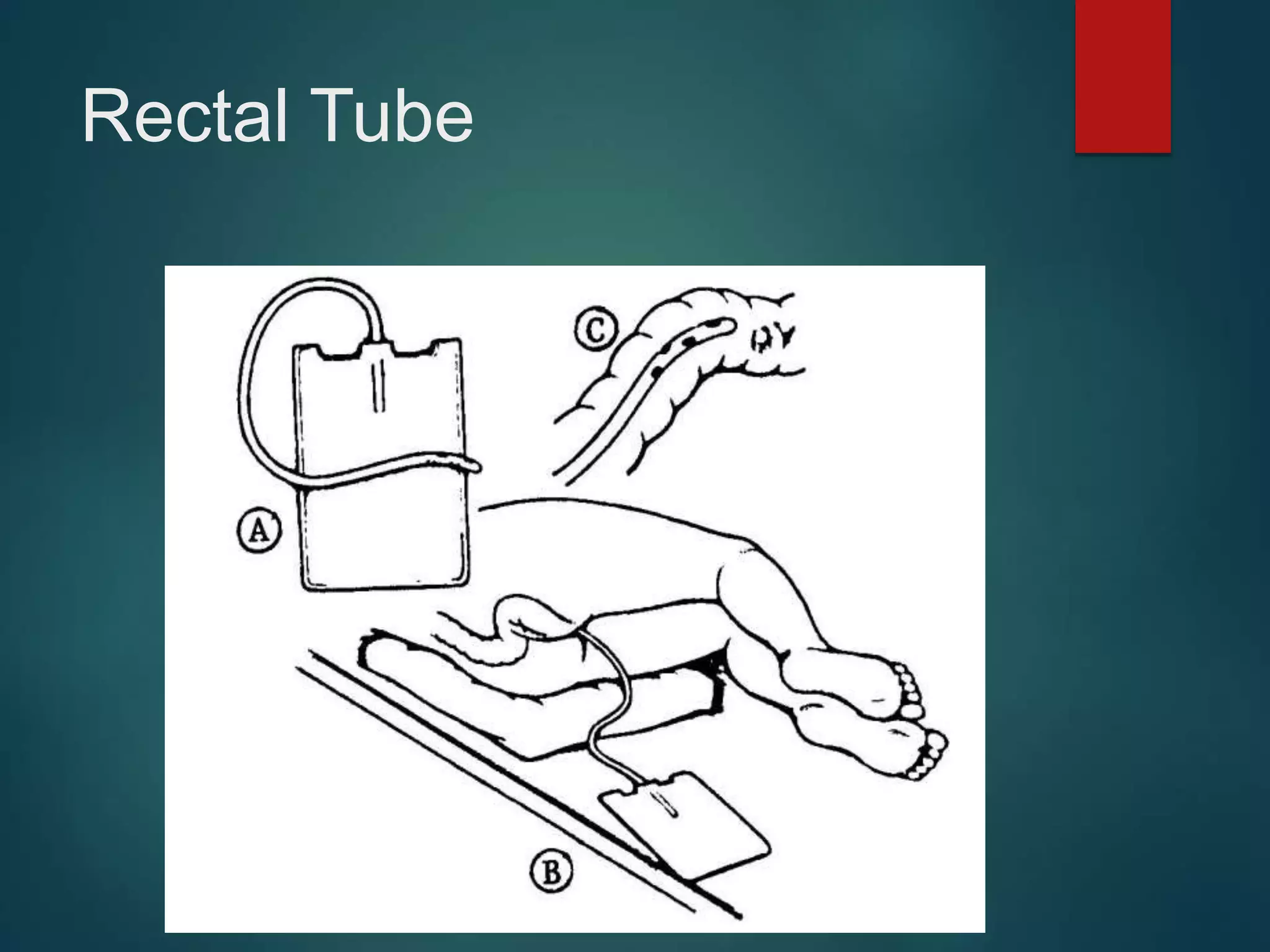 DRAINS AND DRAINAGE SYSTEMS IN SURGERY PPT - Corrected.ppt