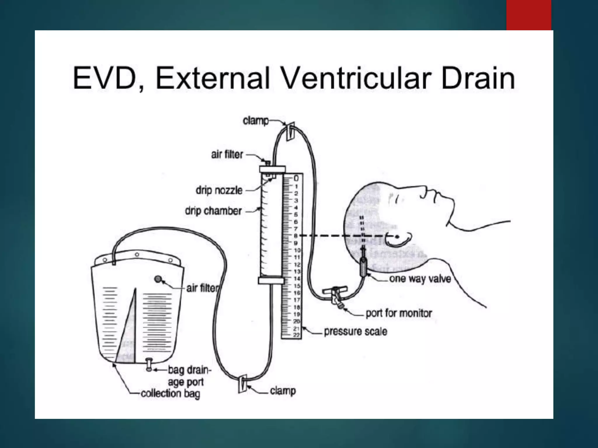 DRAINS AND DRAINAGE SYSTEMS IN SURGERY PPT - Corrected.ppt
