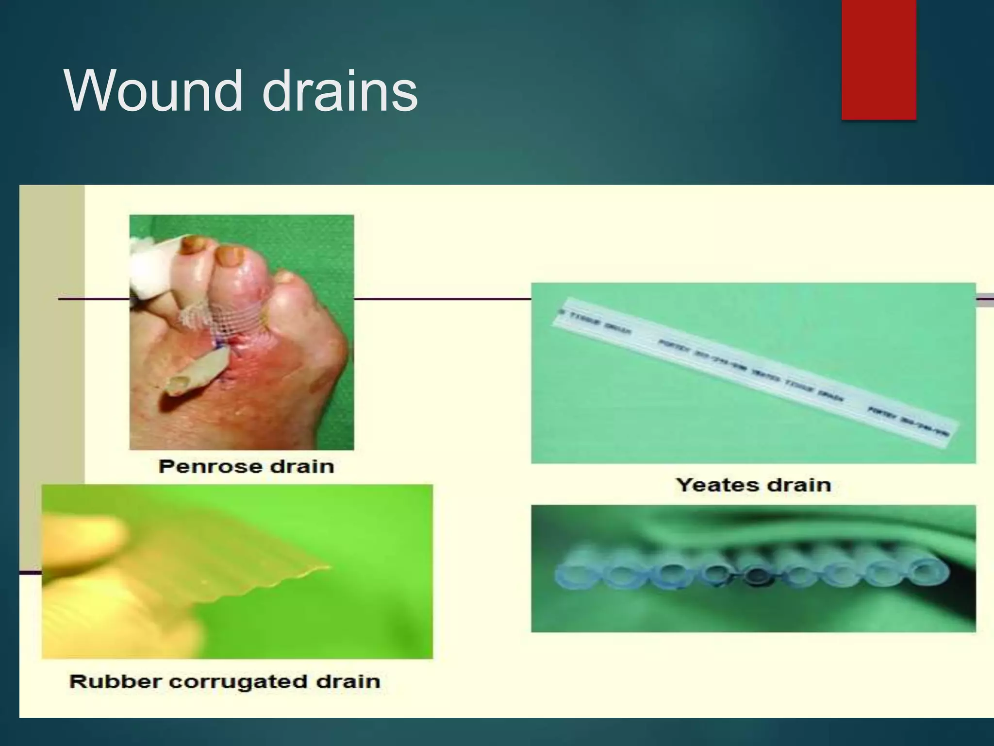 DRAINS AND DRAINAGE SYSTEMS IN SURGERY PPT - Corrected.ppt