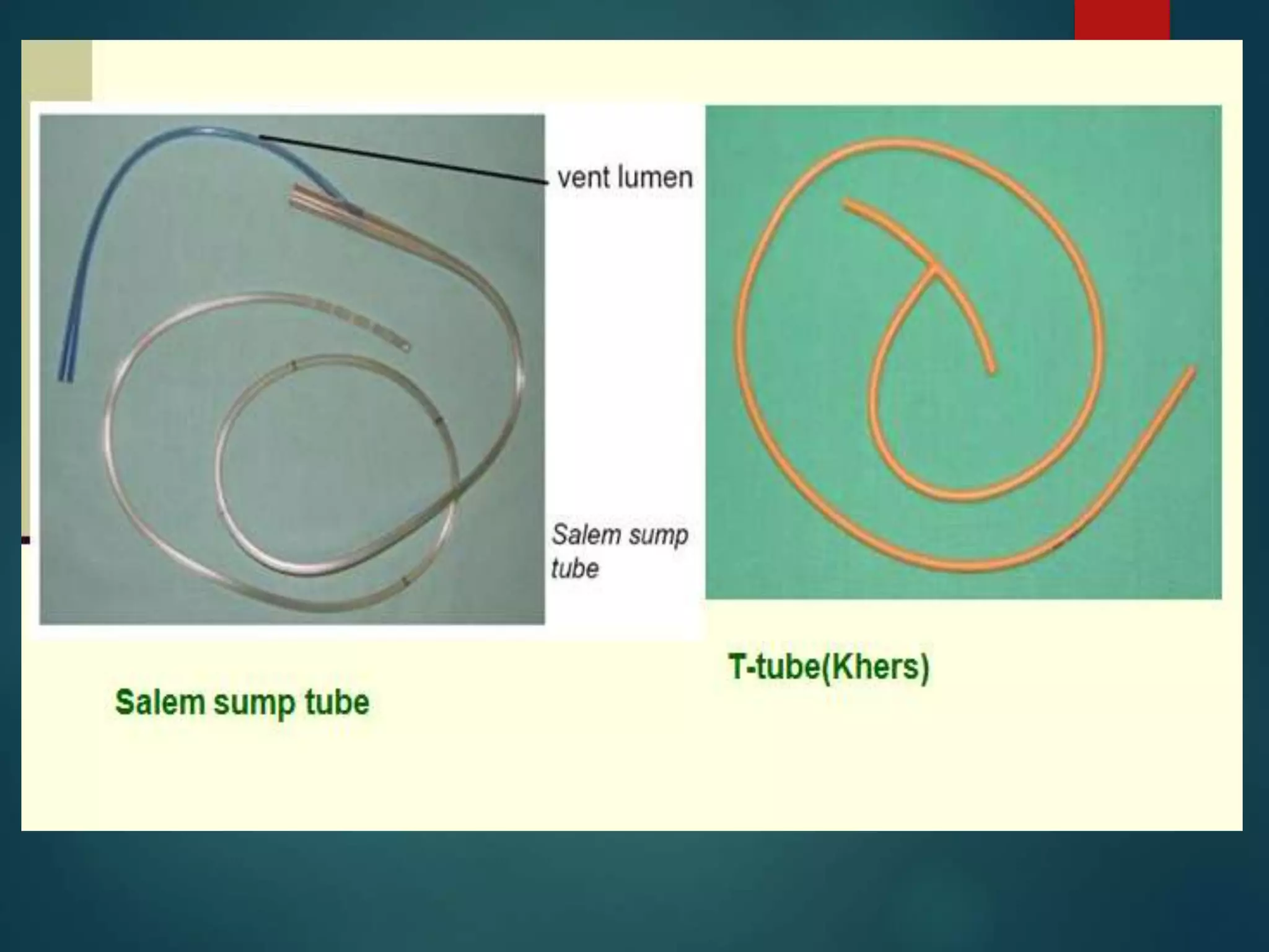 DRAINS AND DRAINAGE SYSTEMS IN SURGERY PPT - Corrected.ppt