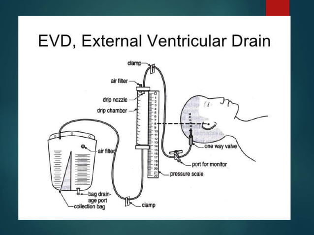 DRAINS AND DRAINAGE SYSTEMS IN SURGERY PPT - Corrected.ppt