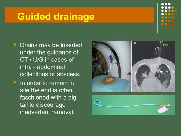 Drains in surgery | PPT | Lung and Respiratory Health | Diseases and ...