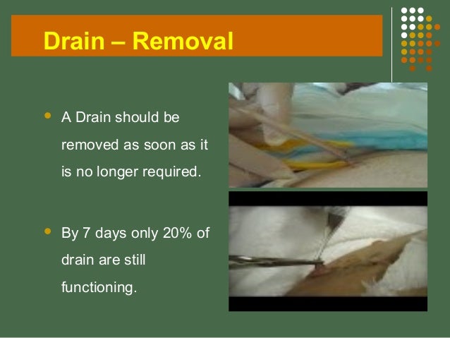 Drains in surgery