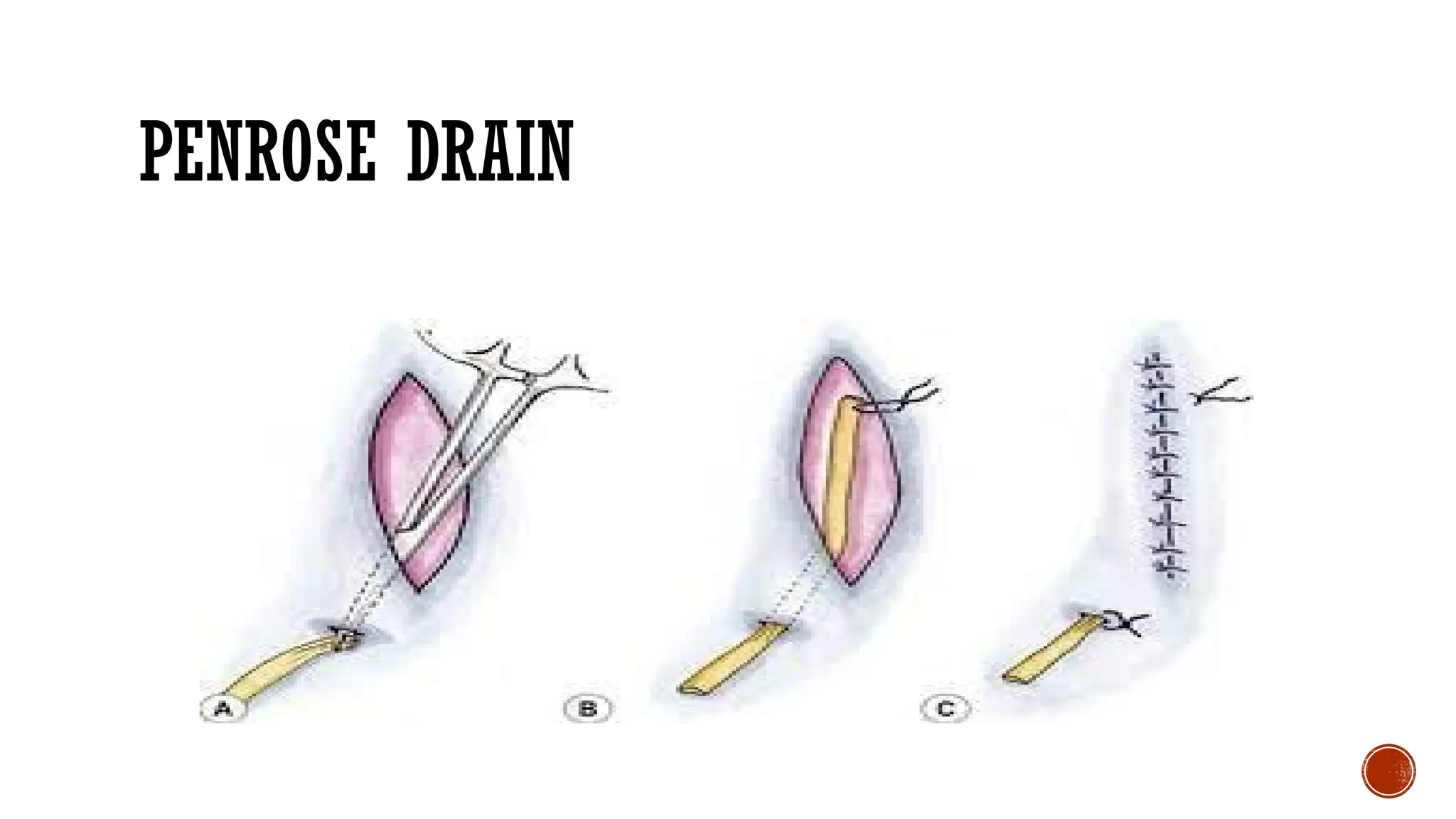 DRAINS IN SURGERY . DR MANISH CHAUDHARY SURGERY RESIDENT,COMSTH, 2024 ...