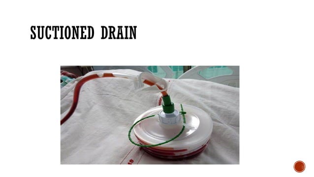 DRAINS IN SURGERY . DR MANISH CHAUDHARY SURGERY RESIDENT,COMSTH, 2024 ...