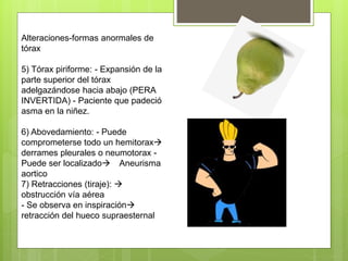 semiologia torax | PPTX
