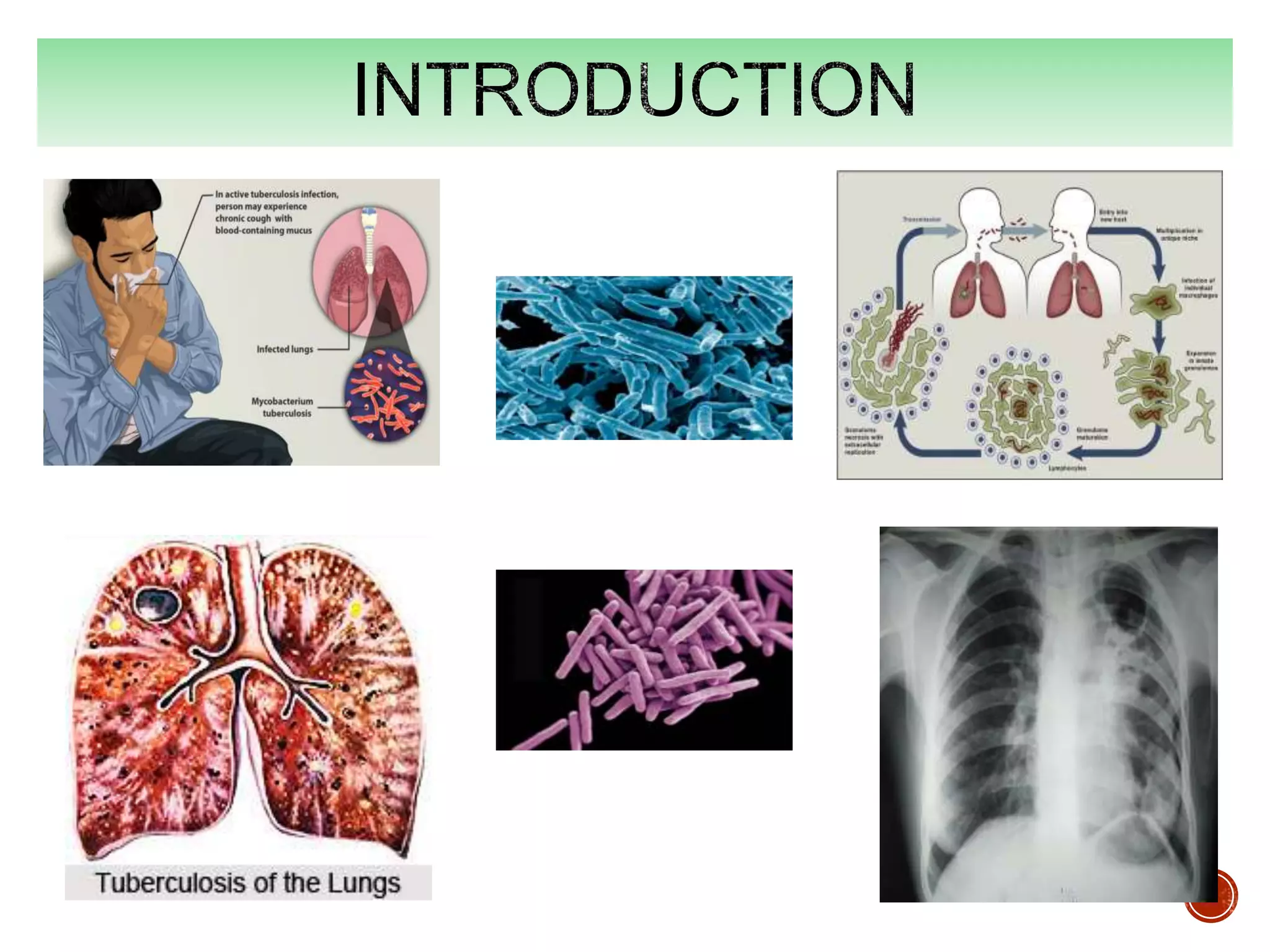 ROLE OF IMMUNOLOGY AND VACCINATION IN TUBERCULOSIS BY DR AJITH | PPT