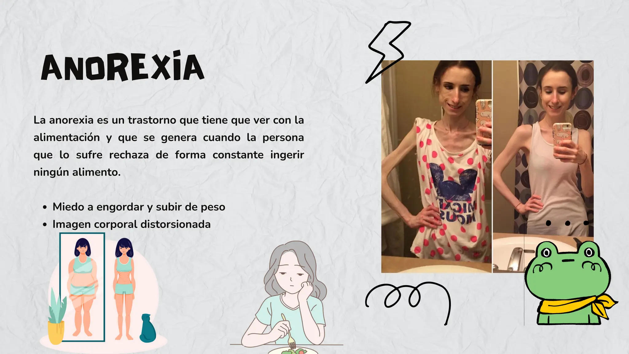 Trastornos alimenticios anorexia bulimia obesidad desnutricion | PDF