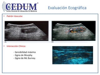 Ecografia de vias digestivas | PPTX