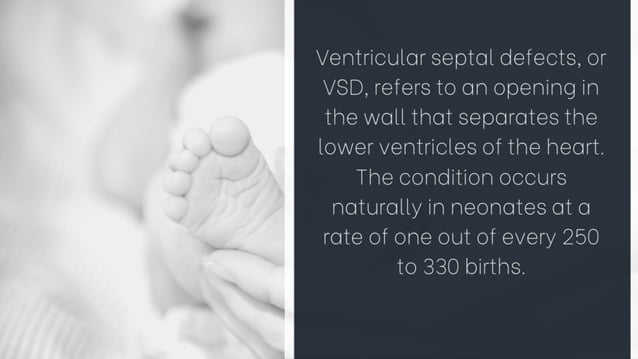 Neonatal Septal Defects: An Overview | PPT