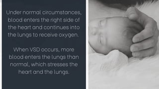 Neonatal Septal Defects: An Overview | PPT