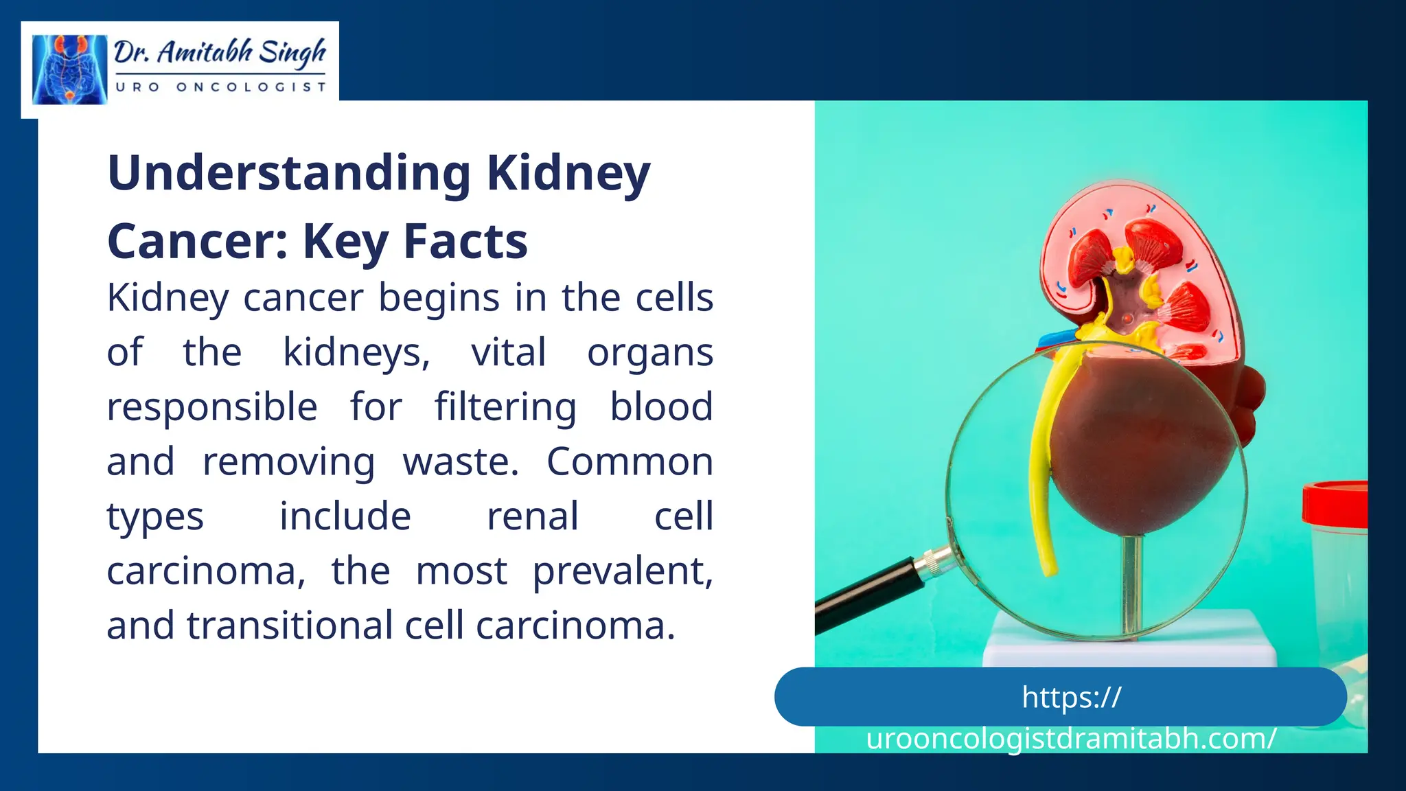 Understanding Kidney Cancer: Key Facts PPT | PPTX