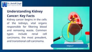 Understanding Kidney Cancer: Key Facts PPT | PPTX