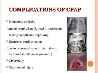 Non-invasive Ventilation (CPAP) in Newborns | PPT