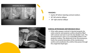 Retrograde uretherogram and Micturating cysto-uretherogram | PPTX