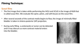 Retrograde uretherogram and Micturating cysto-uretherogram | PPTX