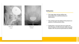 Retrograde uretherogram and Micturating cysto-uretherogram | PPTX
