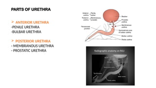 Retrograde uretherogram and Micturating cysto-uretherogram | PPTX