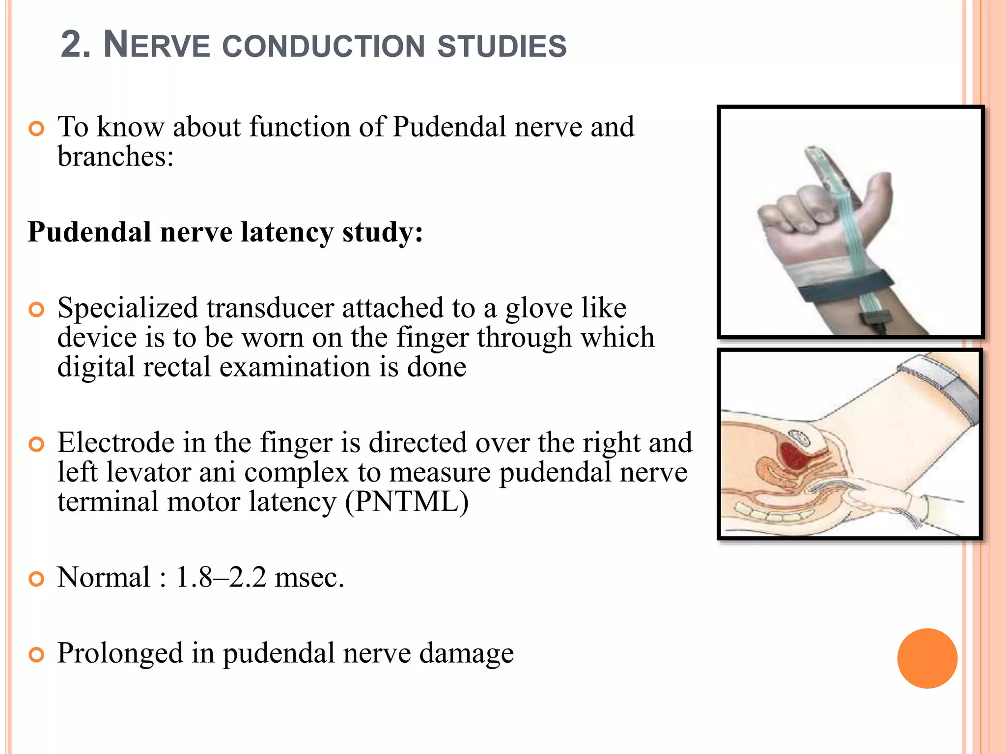 Dr Anisha Rectal prolapse.pptx