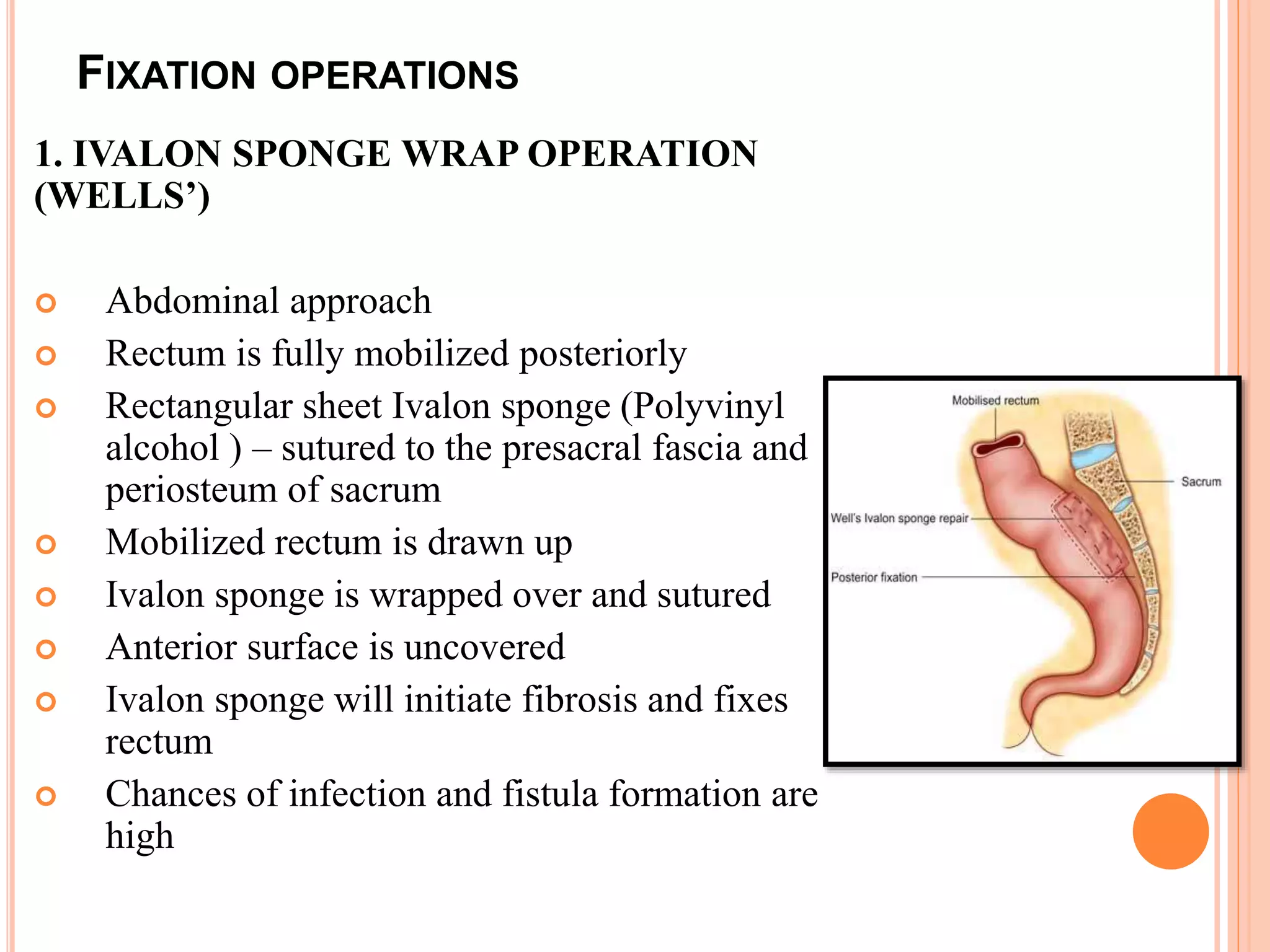 Dr Anisha Rectal prolapse.pptx