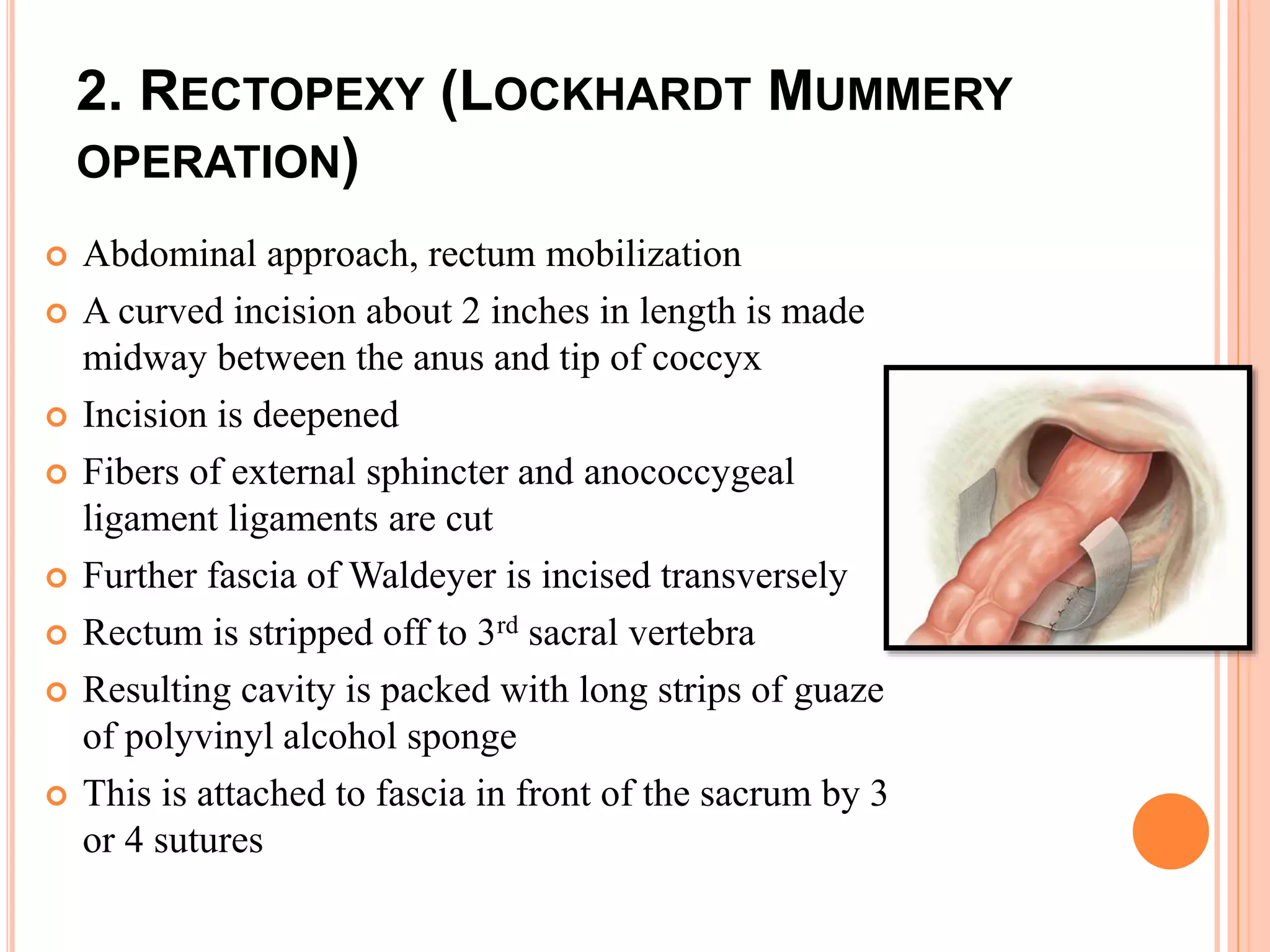 Dr Anisha Rectal prolapse.pptx