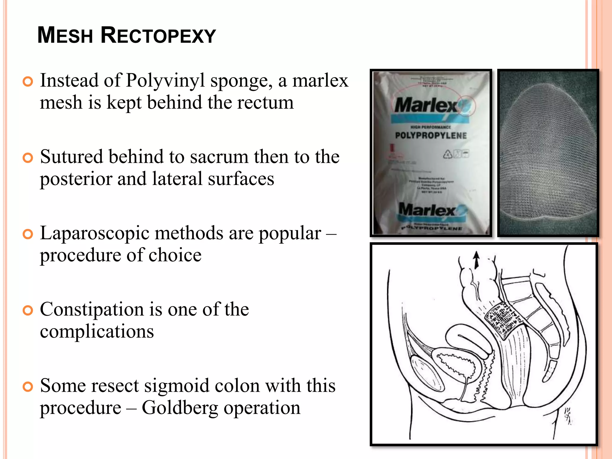 Dr Anisha Rectal prolapse.pptx