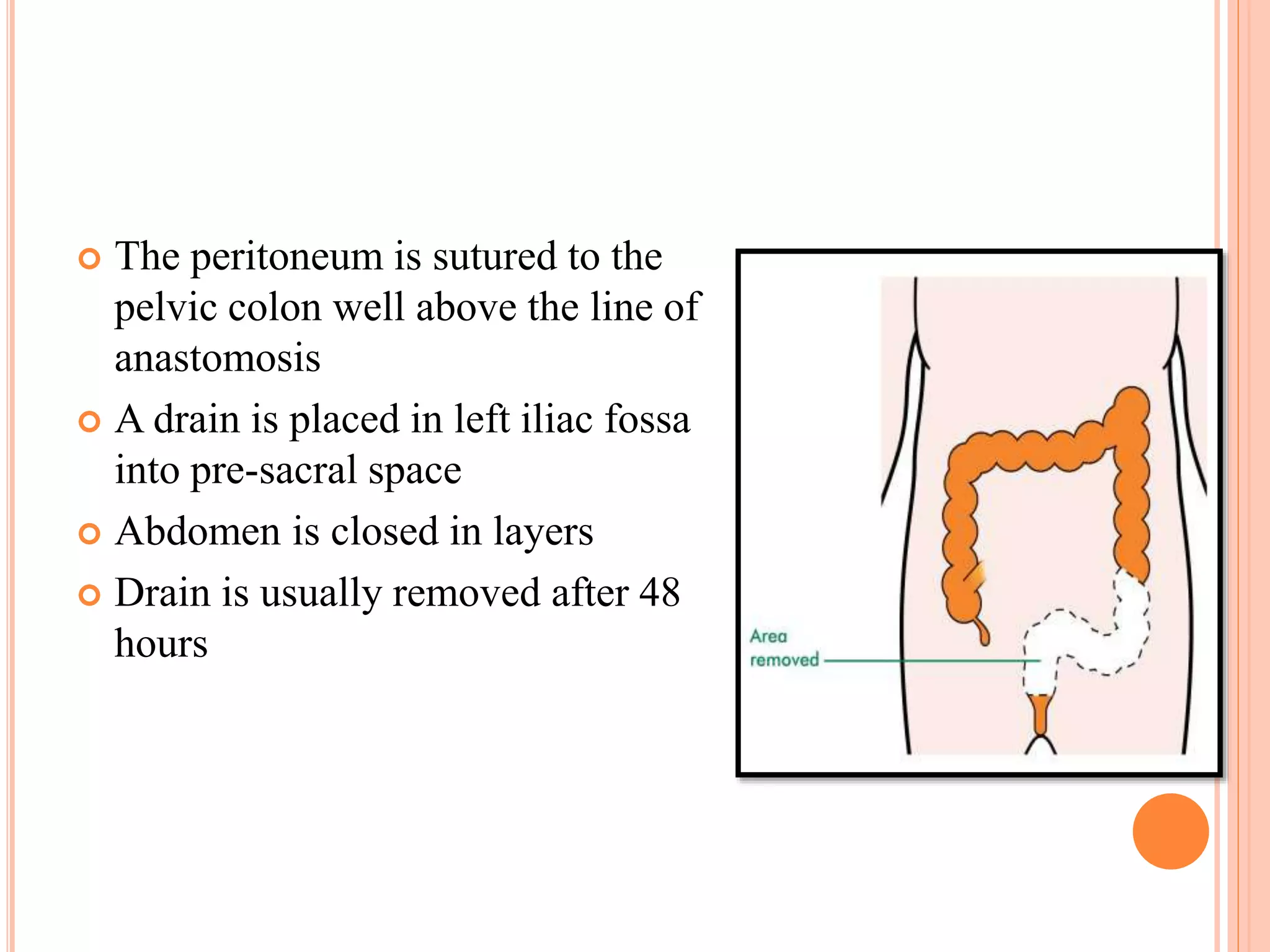 Dr Anisha Rectal prolapse.pptx