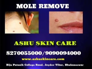 Dr anita rath best laser hair removal doctor in bhubaneswar odisha | PPT